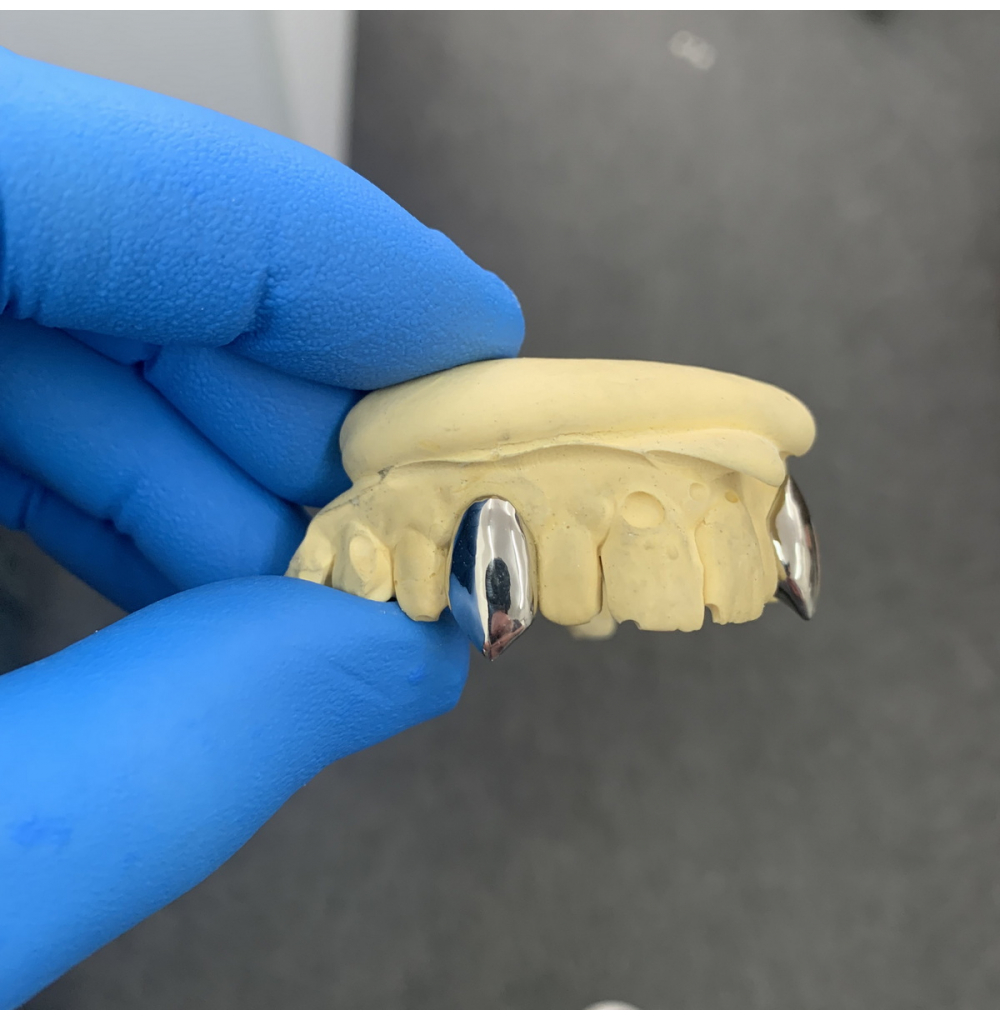 Single Grillz Vampire Fangs Grillz