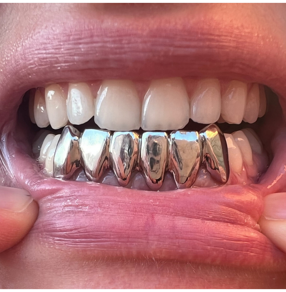 Custom Solid 6 Set Grillz – Premium Designs | GrillzZone UK